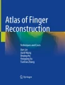 Hand Necrosis | Springer Nature Link