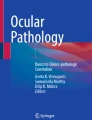 Pathology of the Lens | Springer Nature Link