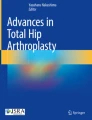 Posterolateral Approach to the Hip | SpringerLink