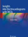 ECG of Pacemakers | Springer Nature Link