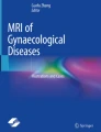 Malignant Mixed Mullerian Tumor (MMMT) in the Uterus | Springer Nature ...