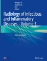 Organizing Pneumonia Versus Usual Interstitial Pneumonia | SpringerLink